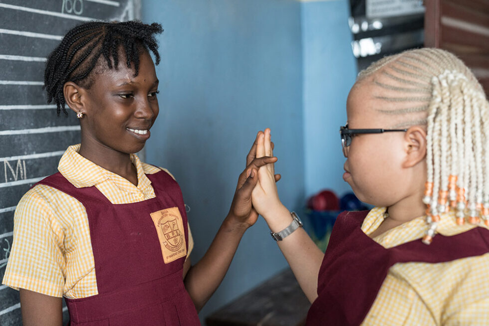 New Research Project | Albinism Sierraleone | Sierra Leone Association ...